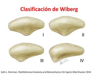 ANATOMIA Y BIOMECANICA PATELOFEMORALV1.1.pptx