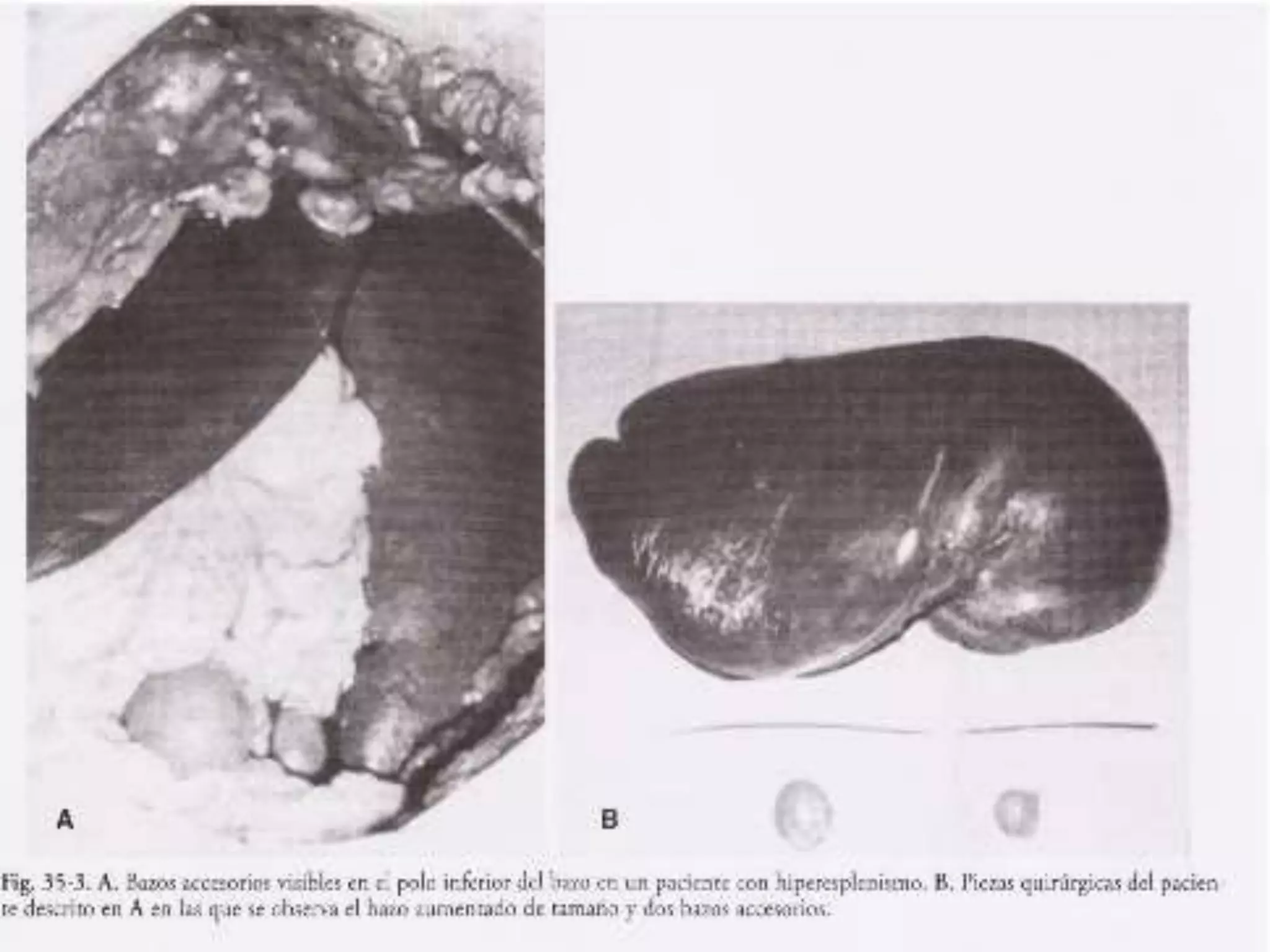 Anatomia y embriologia del bazo hernan | PPTX