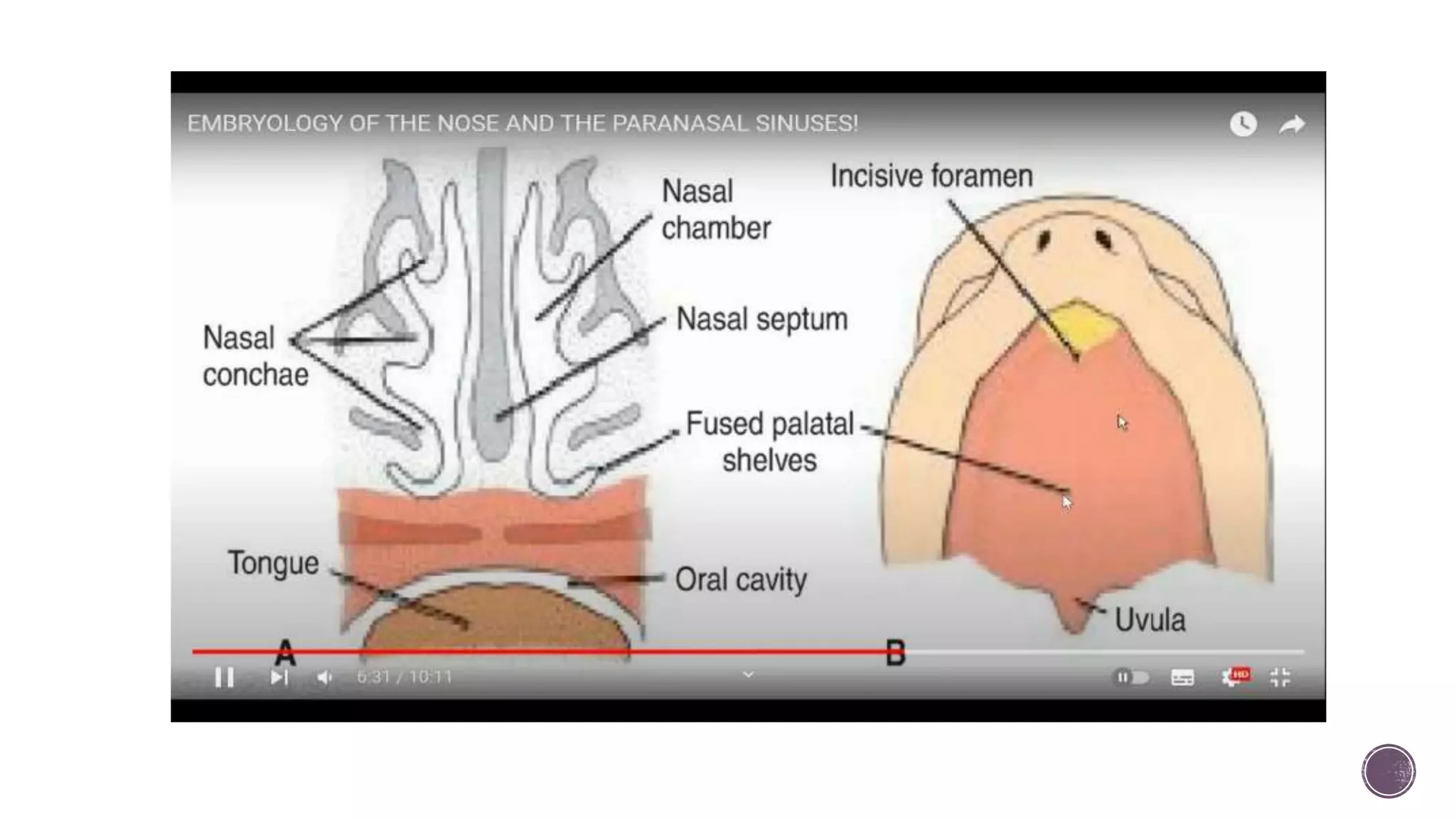 Anatomia y embriologia nasal.pptx