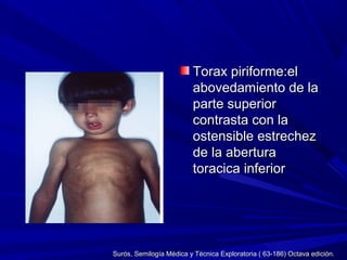 Anatomia y fisiologia del pulmon ok | PPT
