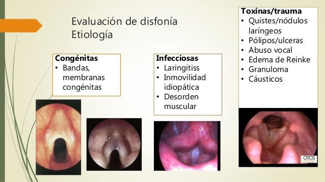 Anatomia y fisiologia laringea