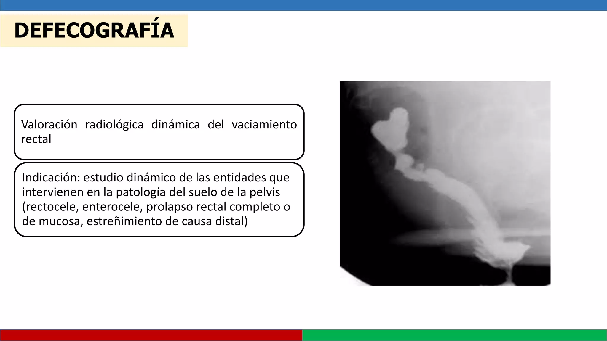 ANATOMIA Y FISIOLOGIA RECTO ANO.pptx