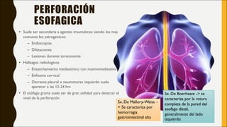 Anatomia y lesiones de esófago.pdf