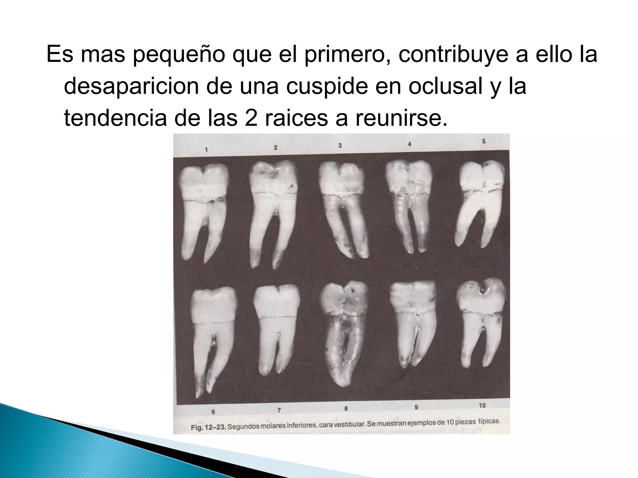 Anatomia y modelado dental exposición | PPT