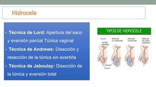 anatomia y patologia testiculares | PPTX