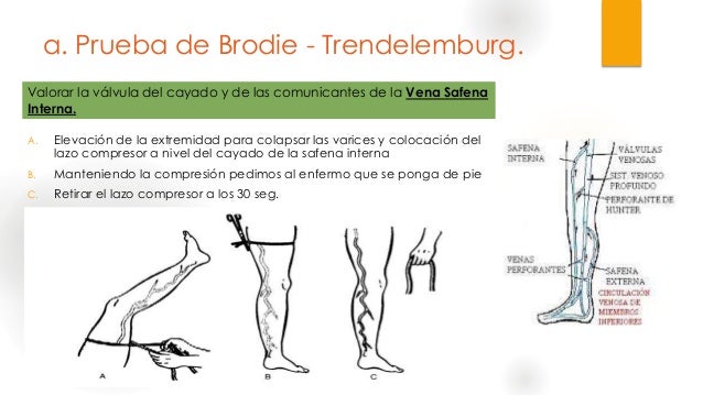 Anatomia y semiologia venosa