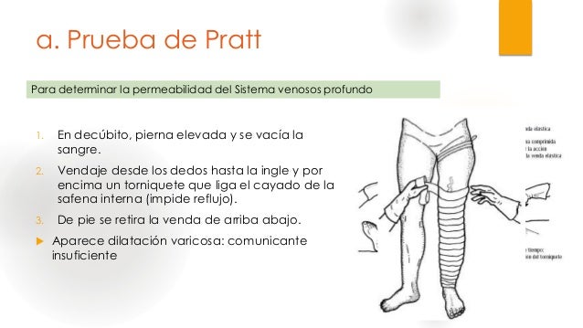 Anatomia y semiologia venosa