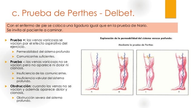 Anatomia y semiologia venosa