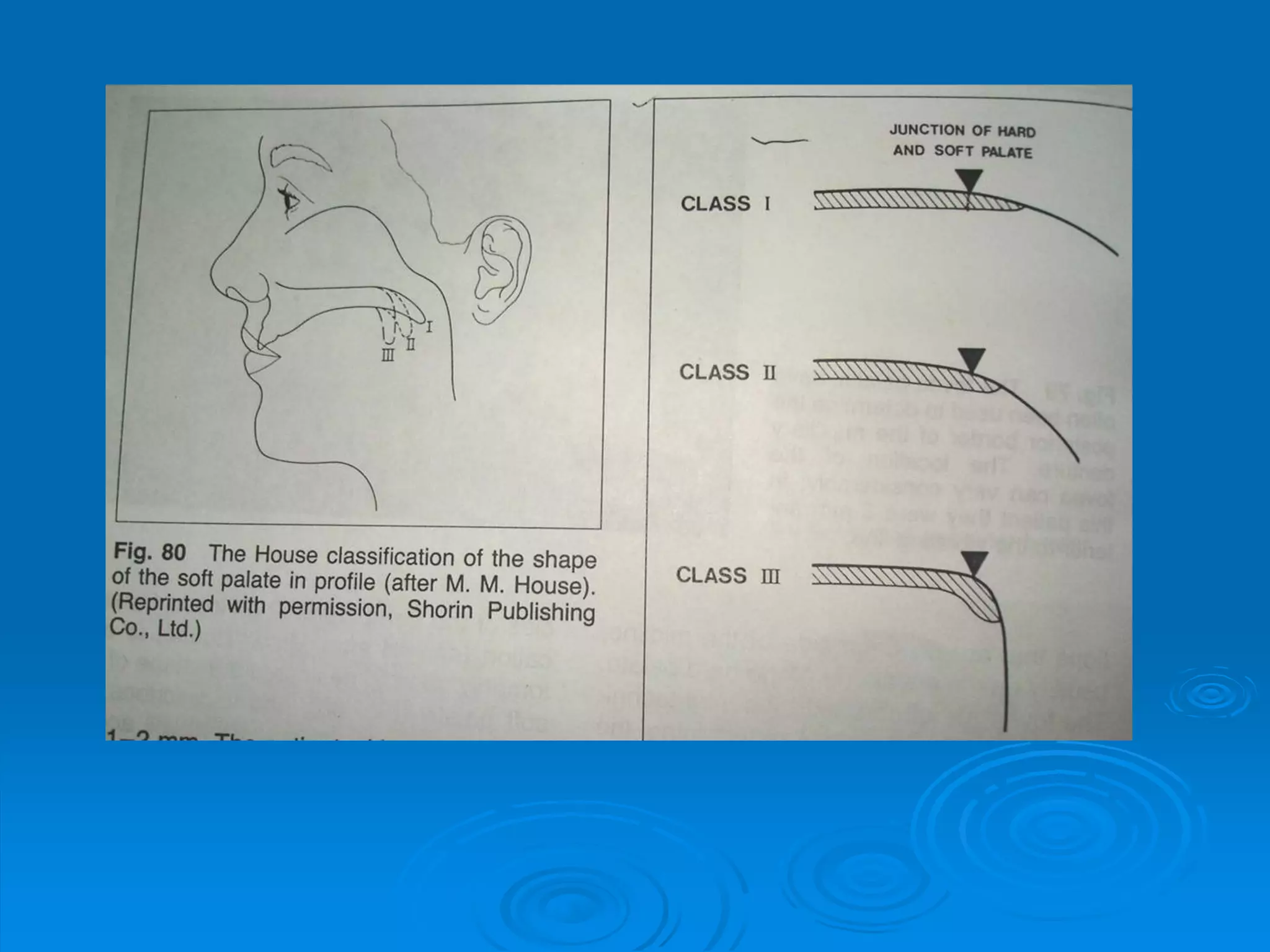 maxillary anatomical landmarks | PPT