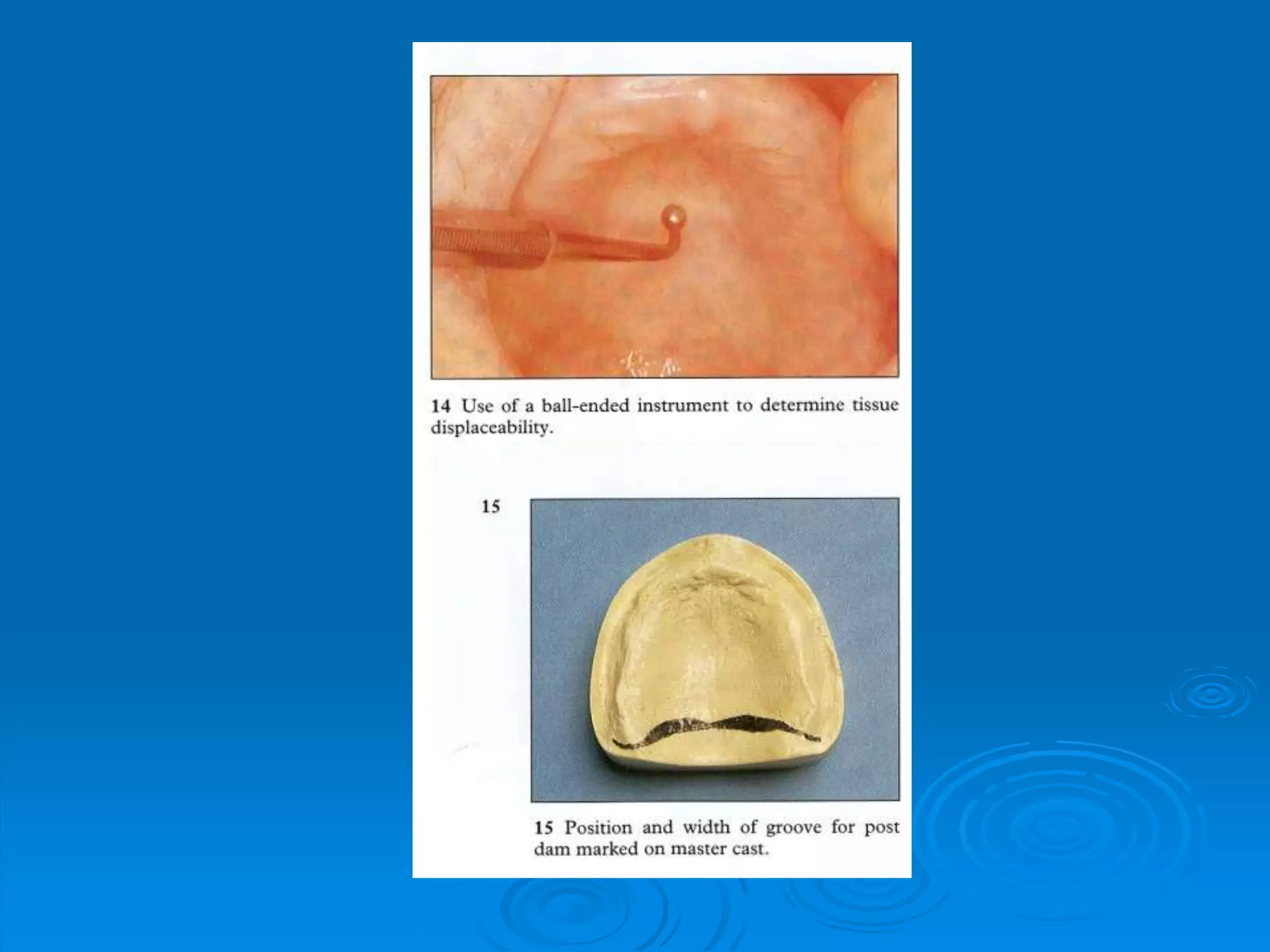 maxillary anatomical landmarks | PPT