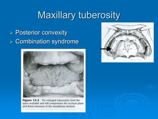 maxillary anatomical landmarks | PPT | Dental Health | Diseases and ...