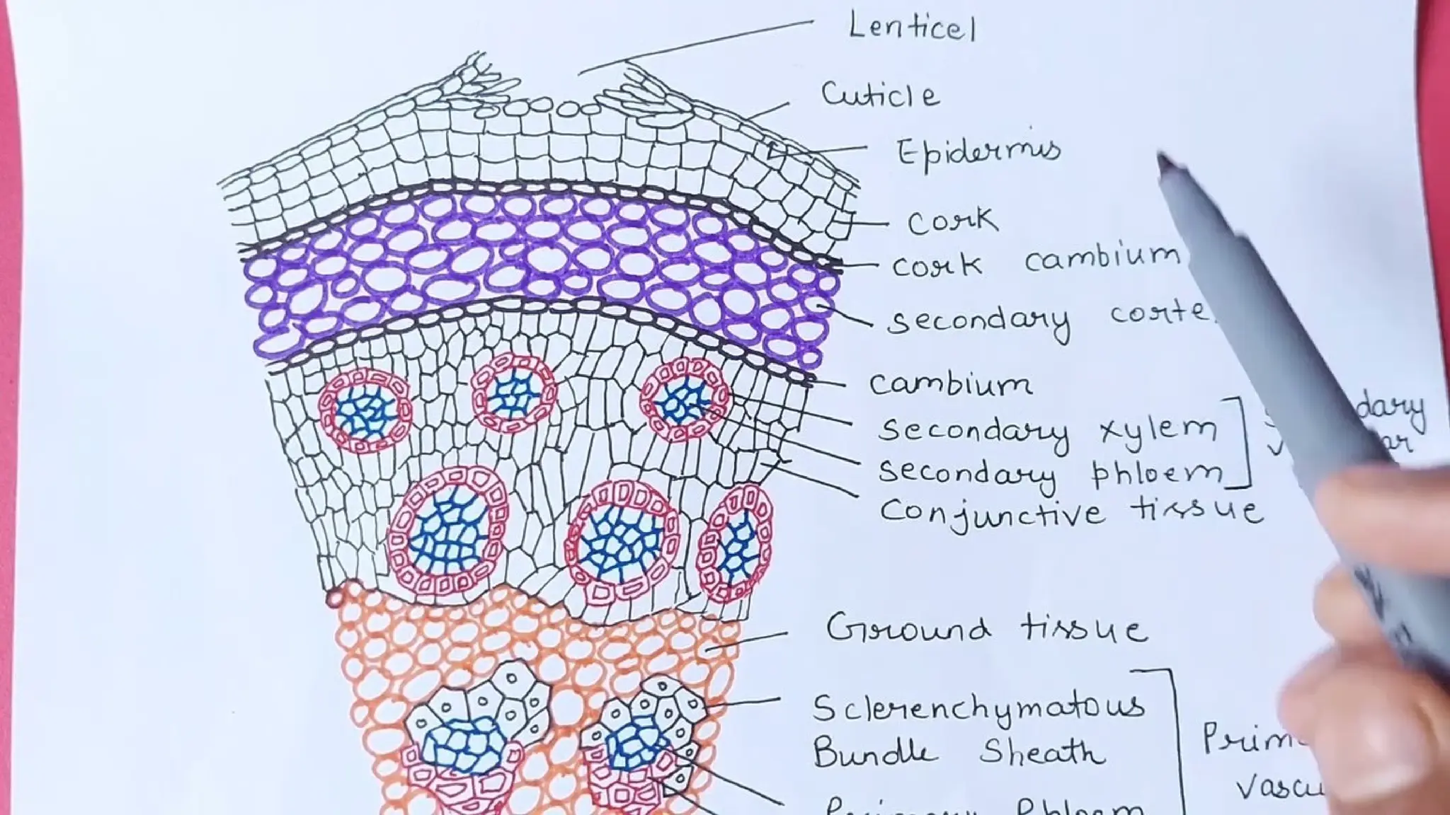 Anatomical anomalies in the primary structure of Dicot.pptx