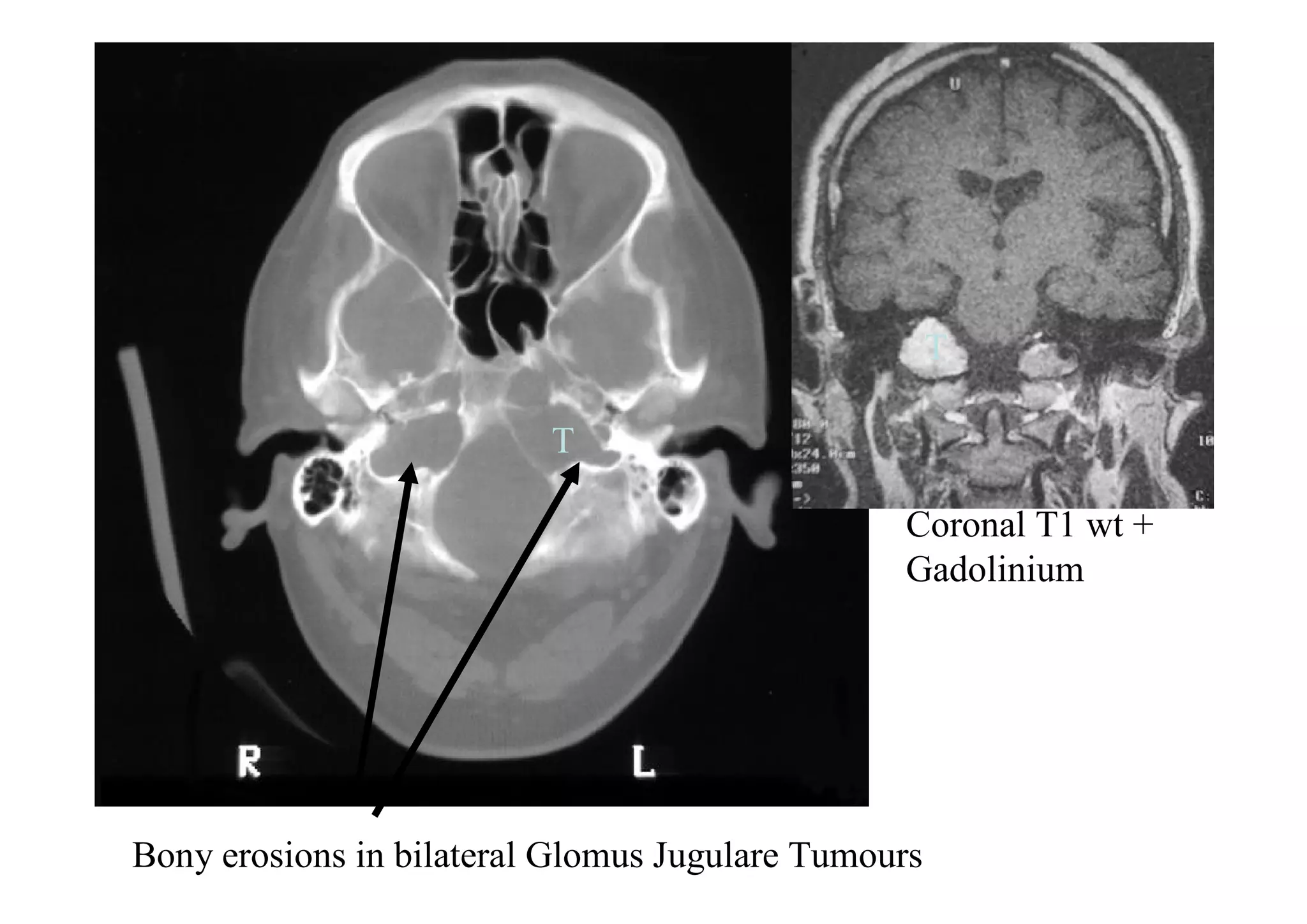Anatomical aspects of radiology anatomy, differential diagnosis and the ...