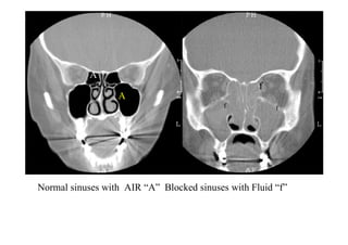 Anatomical aspects of radiology anatomy, differential diagnosis and the ...