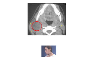 Anatomical aspects of radiology anatomy, differential diagnosis and the ...