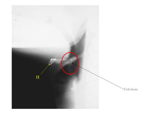 Anatomical aspects of radiology anatomy, differential diagnosis and the ...