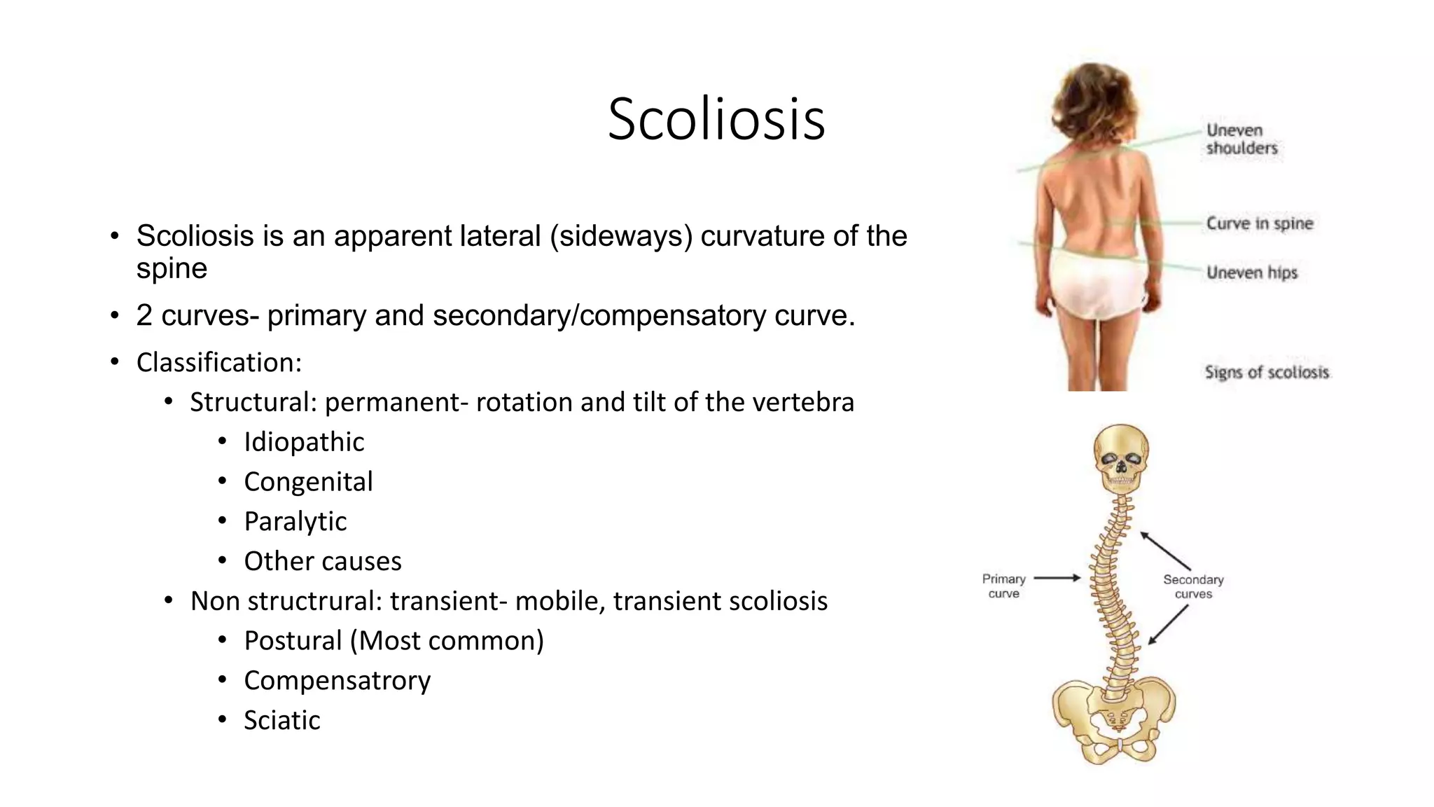 Anatomical basis of common back problems | PPTX