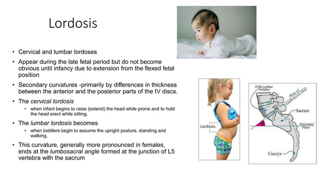 Anatomical basis of common back problems | PPT