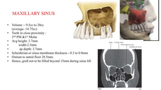 ANATOMICAL CONSIDERATIONS IN MAXILLA FOR ORAL IMPLANTS.pptx