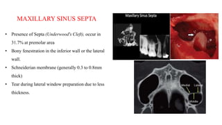 ANATOMICAL CONSIDERATIONS IN MAXILLA FOR ORAL IMPLANTS.pptx