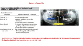 ANATOMICAL CONSIDERATIONS IN MAXILLA FOR ORAL IMPLANTS.pptx