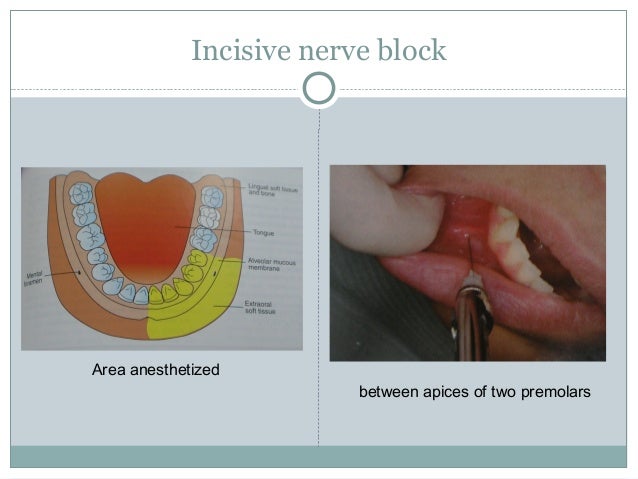 Anatomical correlation of local anesthesia in dentistry