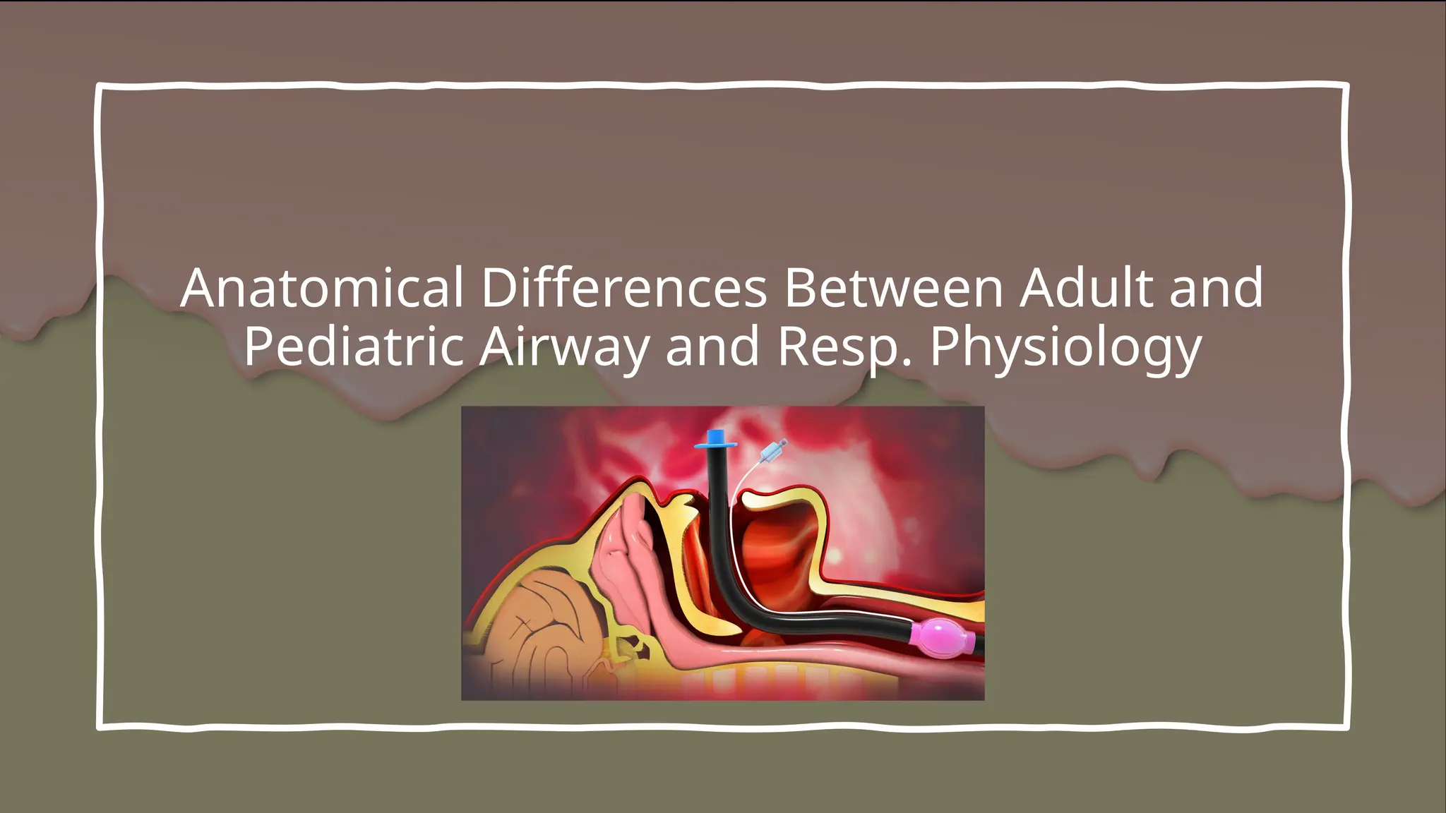 Anatomical Differences Between Adult and Pediatric Airway and.pptx