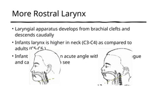 Anatomical Differences Between Adult and Pediatric Airway and.pptx