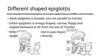 Anatomical Differences Between Adult and Pediatric Airway and.pptx