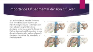 Anatomical division of liver | PPTX