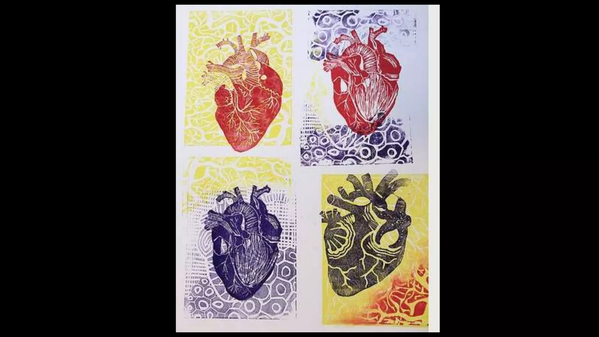 Anatomy linocut | PPTX