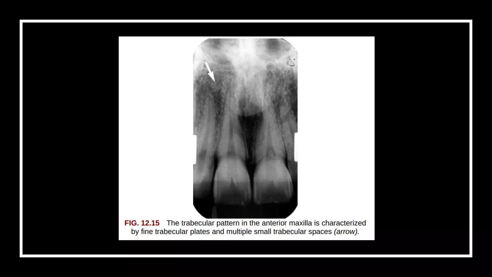 Anatomical landmark in oral radiology | PPTX