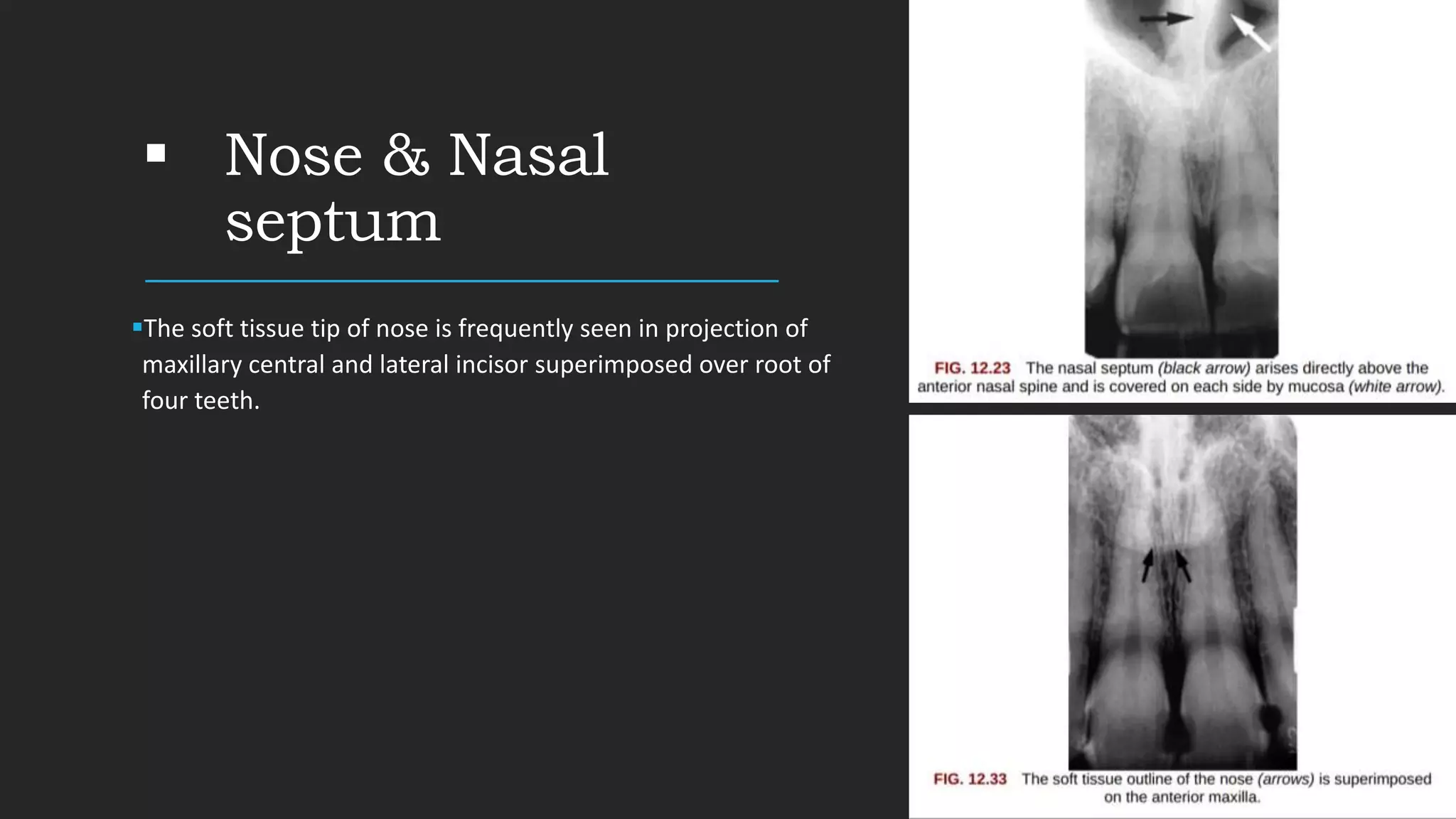 Anatomical landmark in oral radiology | PPTX