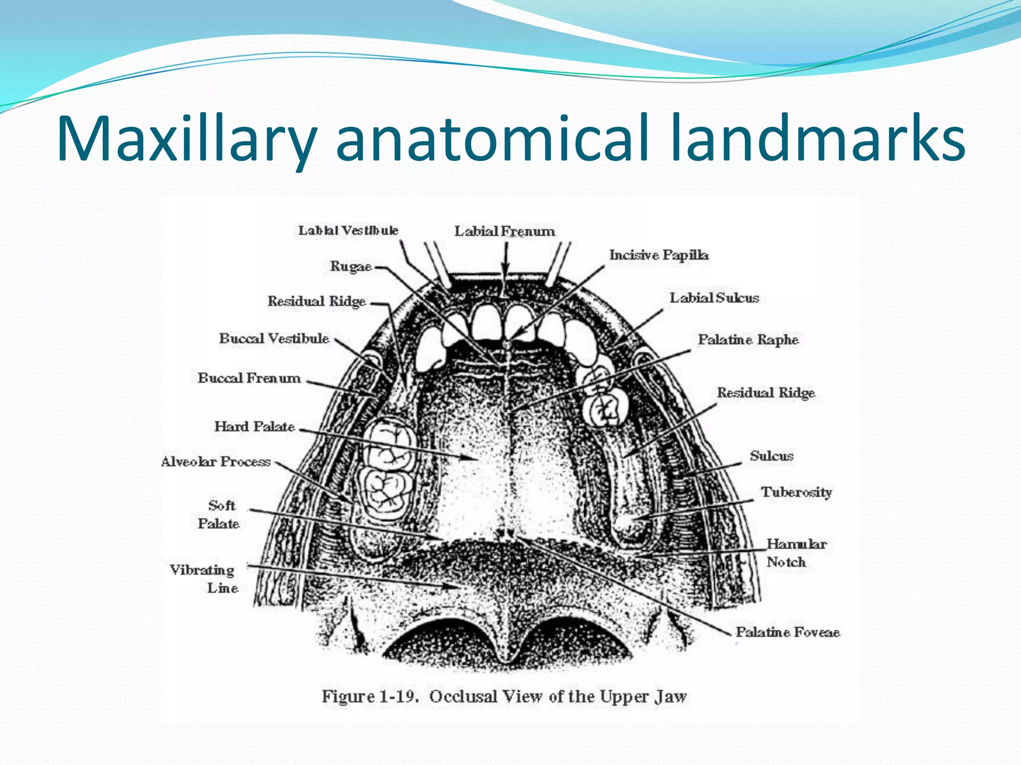 Anatomical Landmarks for Complete Dentures | PPTX