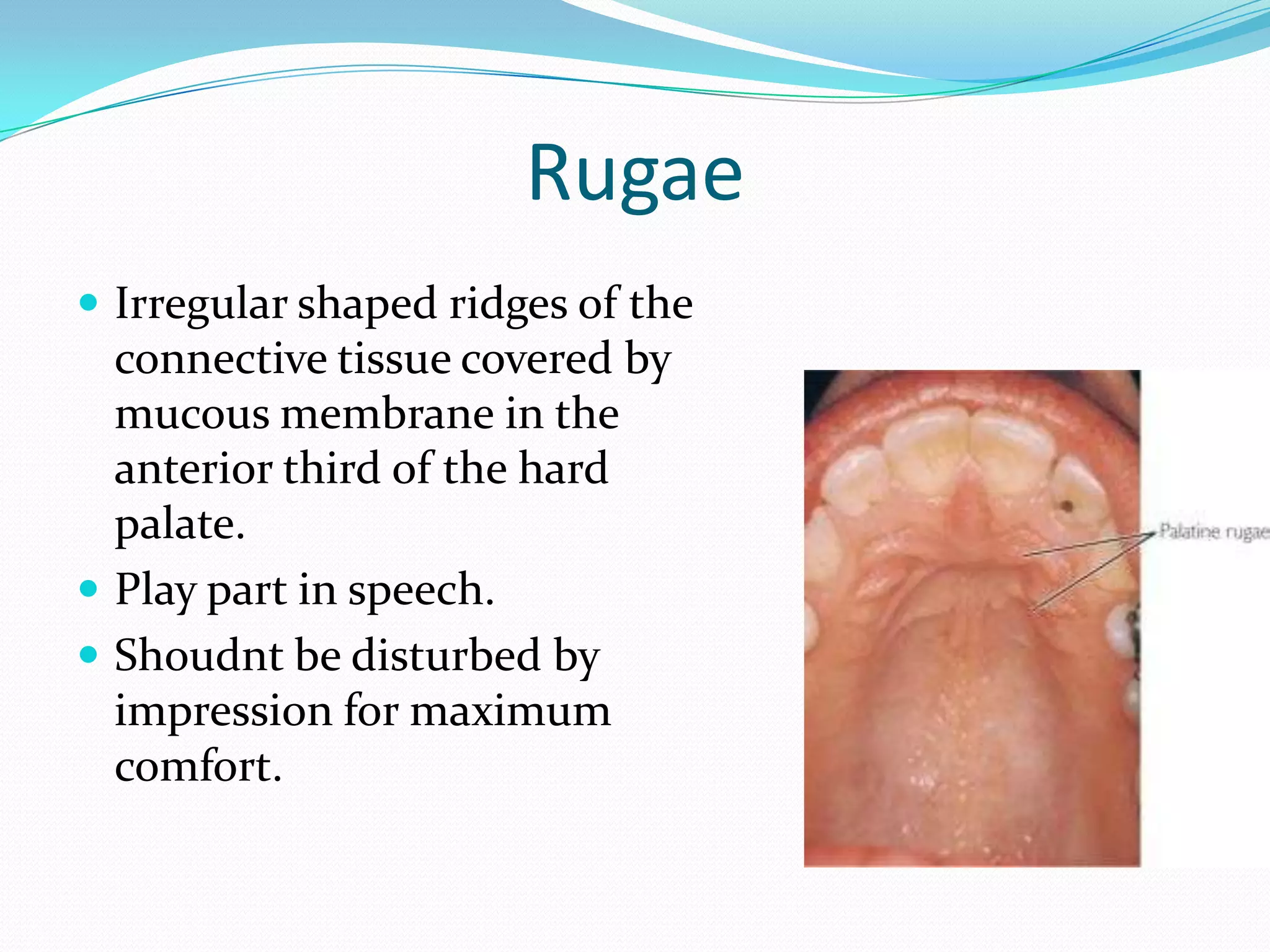 Anatomical Landmarks for Complete Dentures | PPTX