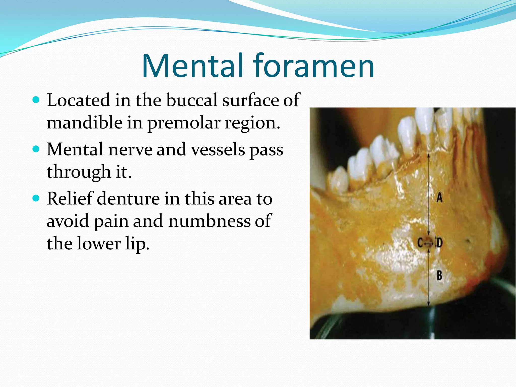 Anatomical Landmarks for Complete Dentures | PPTX
