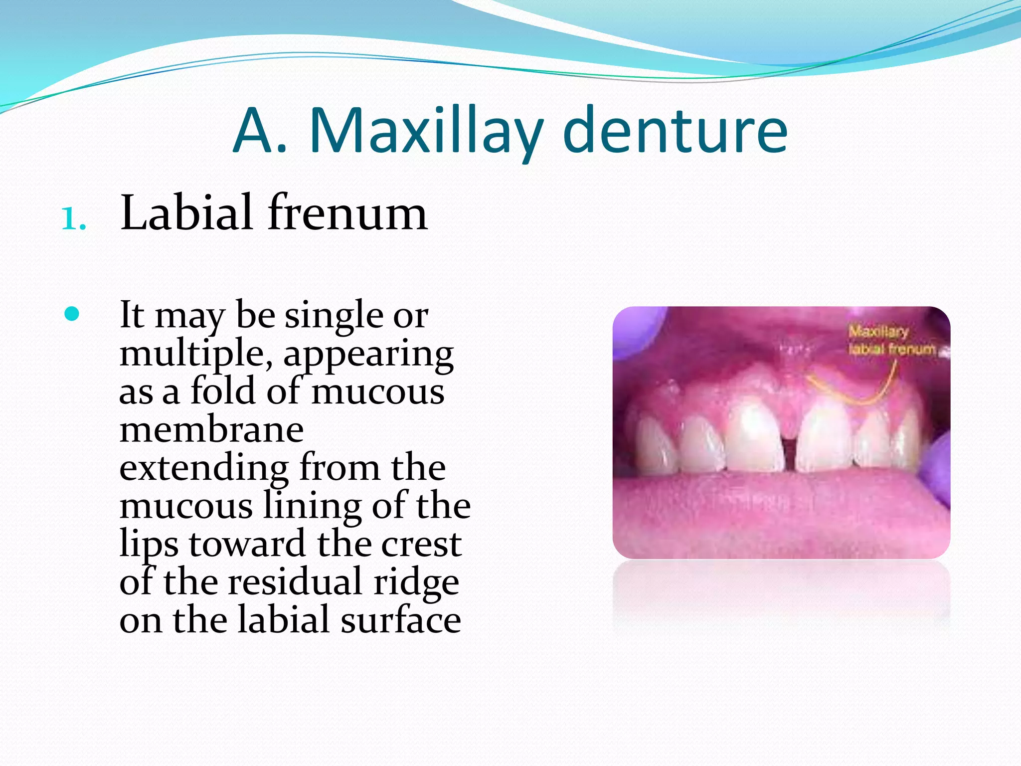 Anatomical Landmarks for Complete Dentures | PPTX