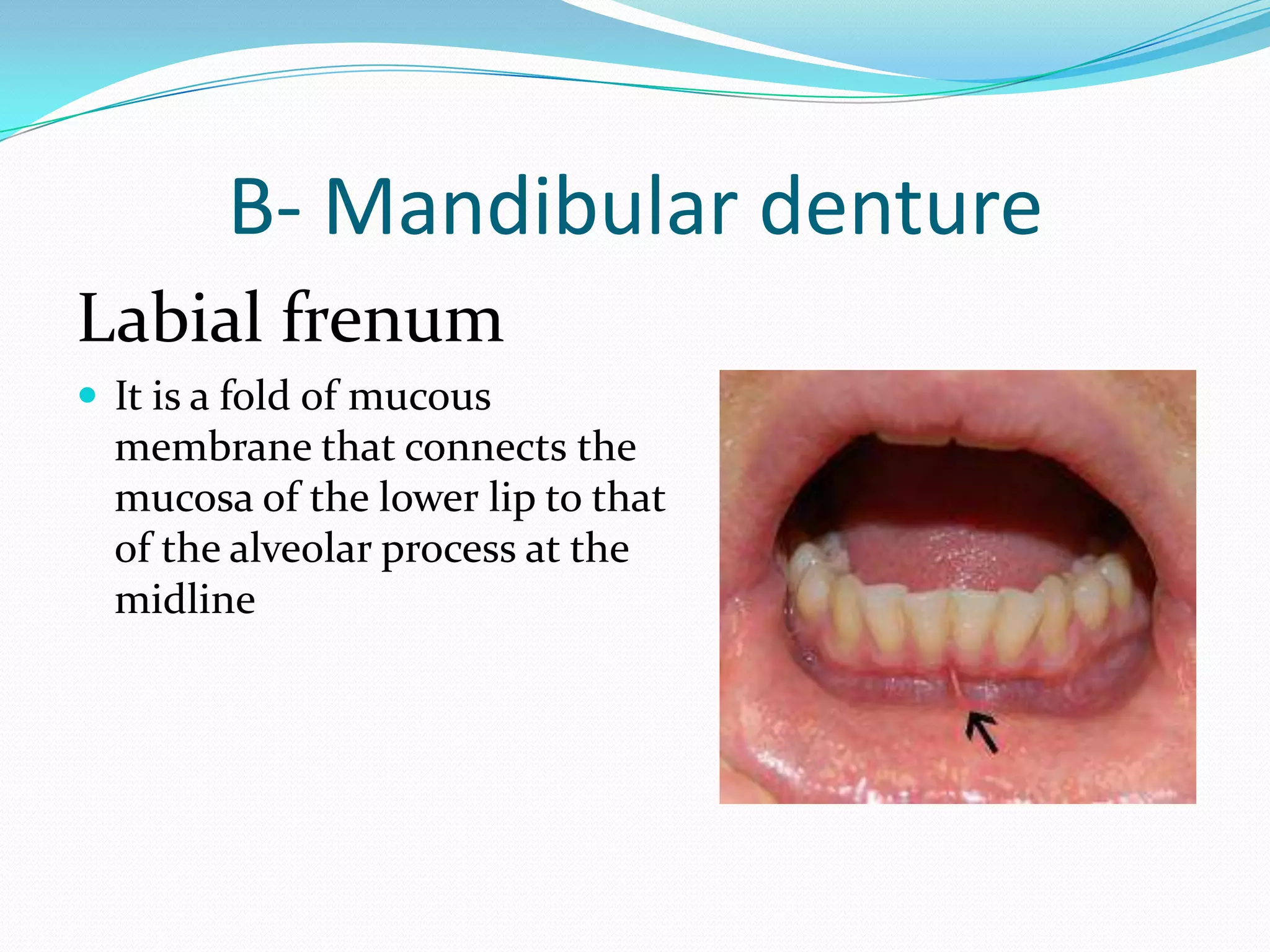 Anatomical Landmarks for Complete Dentures | PPTX