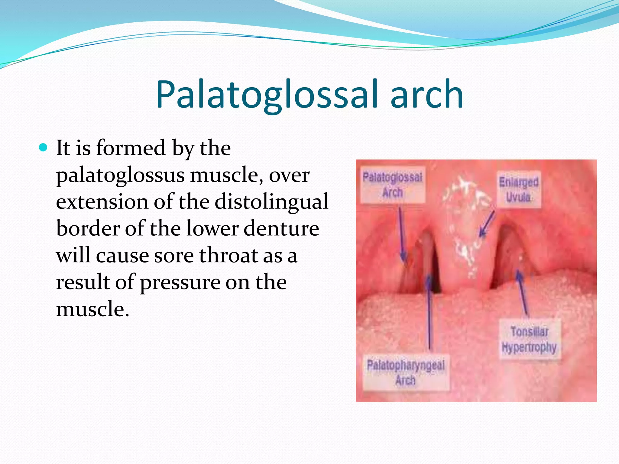 Anatomical Landmarks for Complete Dentures | PPTX
