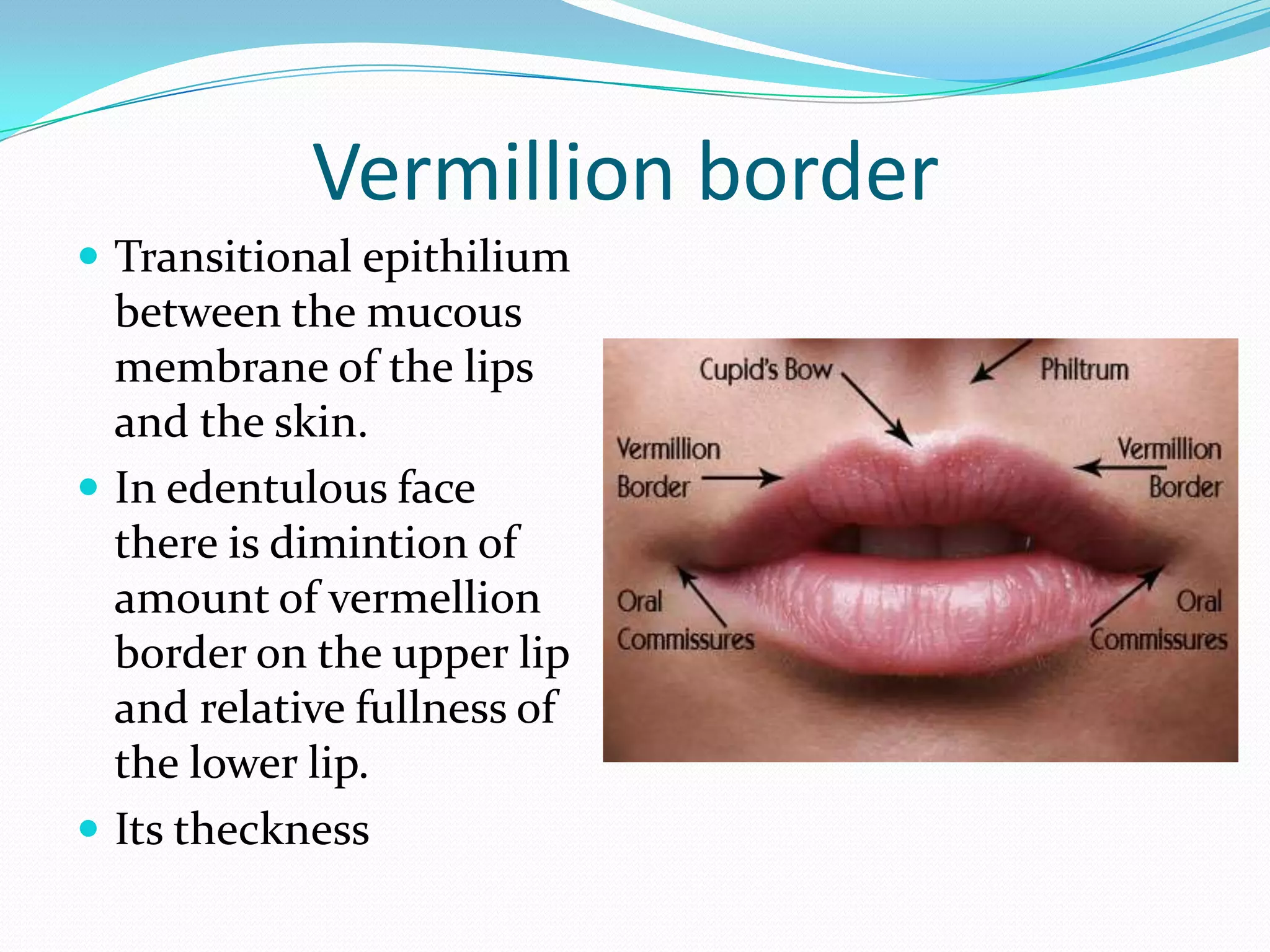 Anatomical Landmarks for Complete Dentures | PPTX