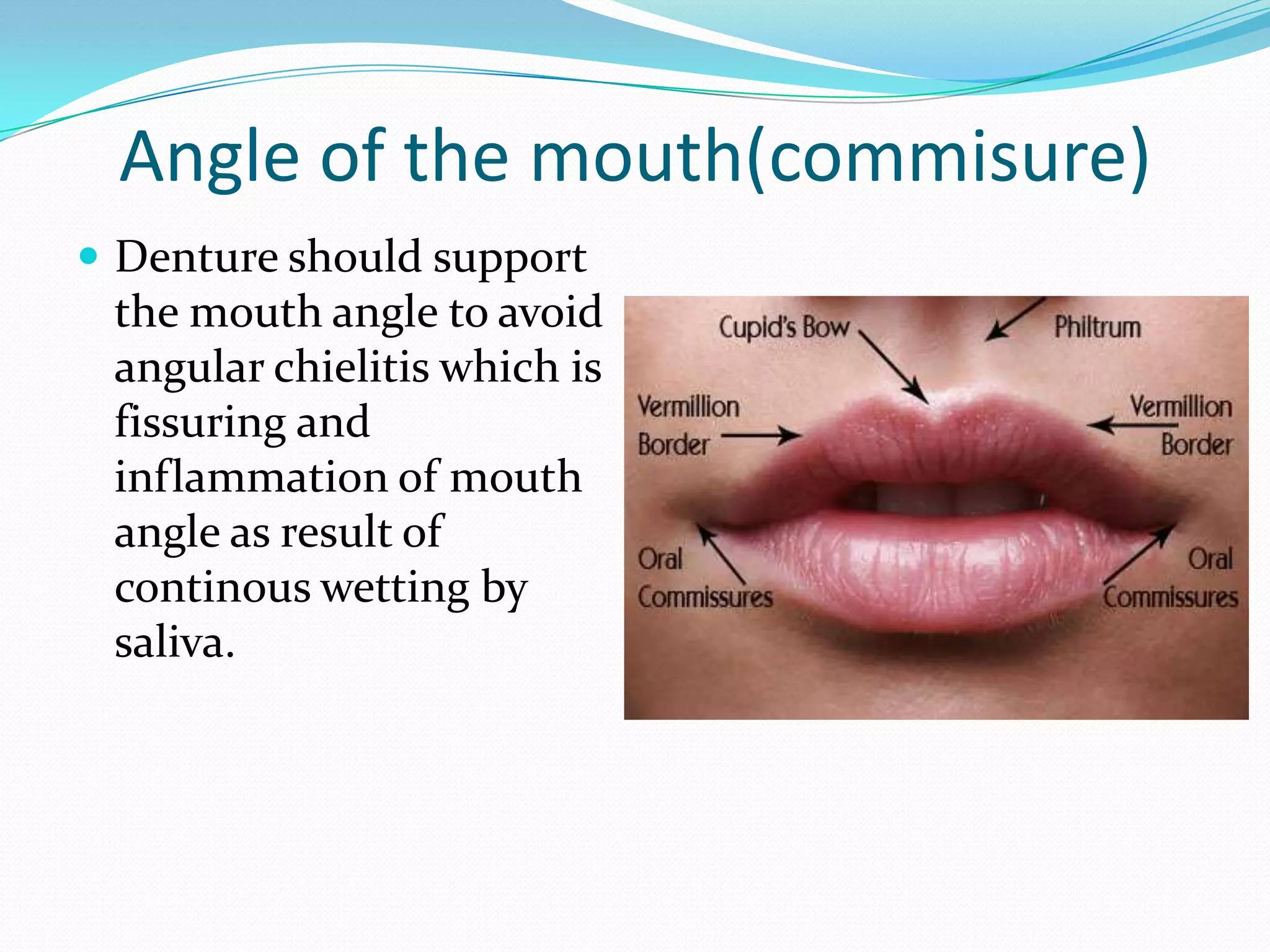 Anatomical Landmarks for Complete Dentures | PPTX