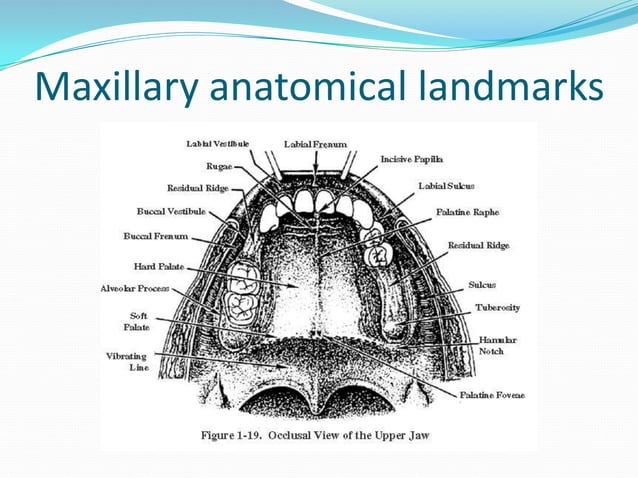 Anatomical Landmarks for Complete Dentures | PPTX | Dental Health ...
