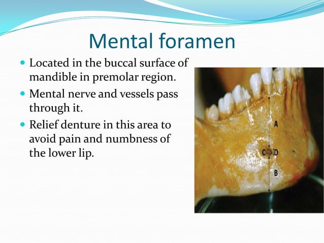 Anatomical Landmarks for Complete Dentures | PPTX | Dental Health ...