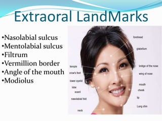 Anatomical Landmarks for Complete Dentures | PPT