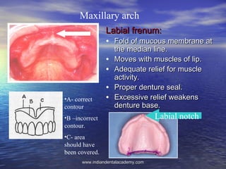 Anatomical landmarks/ dental implant courses by Indian dental academy | PPT