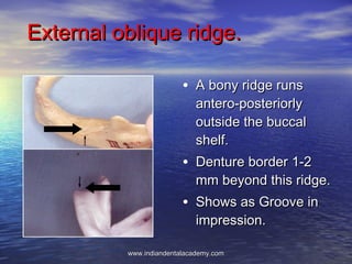 Anatomical landmarks/ dental implant courses by Indian dental academy | PPT