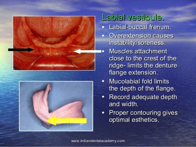 Anatomical landmarks/ dental implant courses by Indian dental academy
