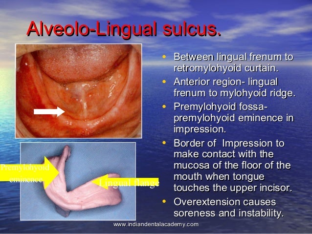 Anatomical landmarks/ dental implant courses by Indian dental academy