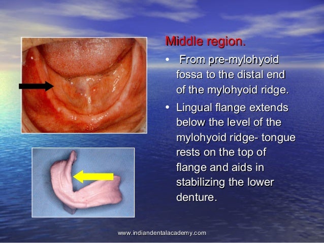 Anatomical landmarks/ dental implant courses by Indian dental academy