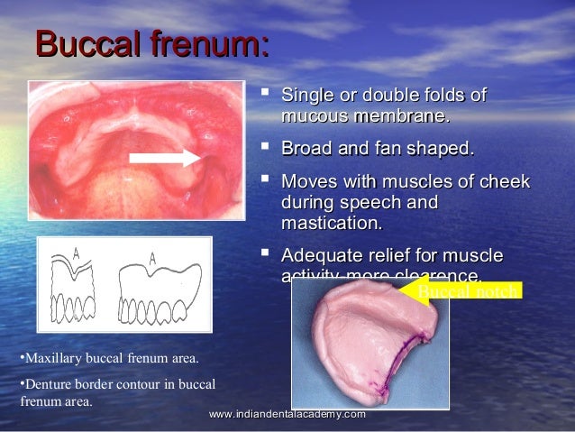 Anatomical landmarks/ dental implant courses by Indian dental academy